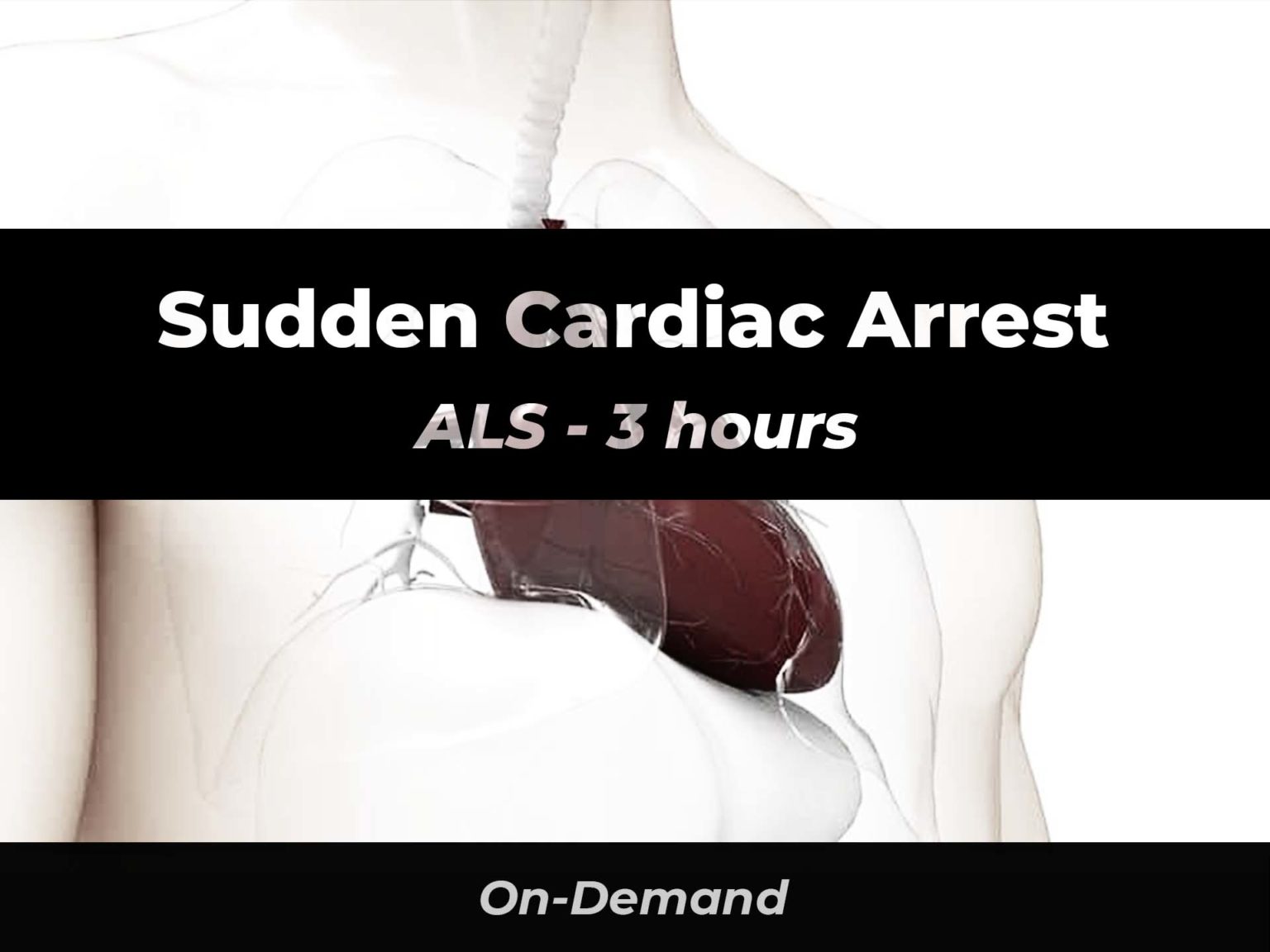 Sudden Cardiac Arrest ALS - 911 e-Learning Solutions, LLC