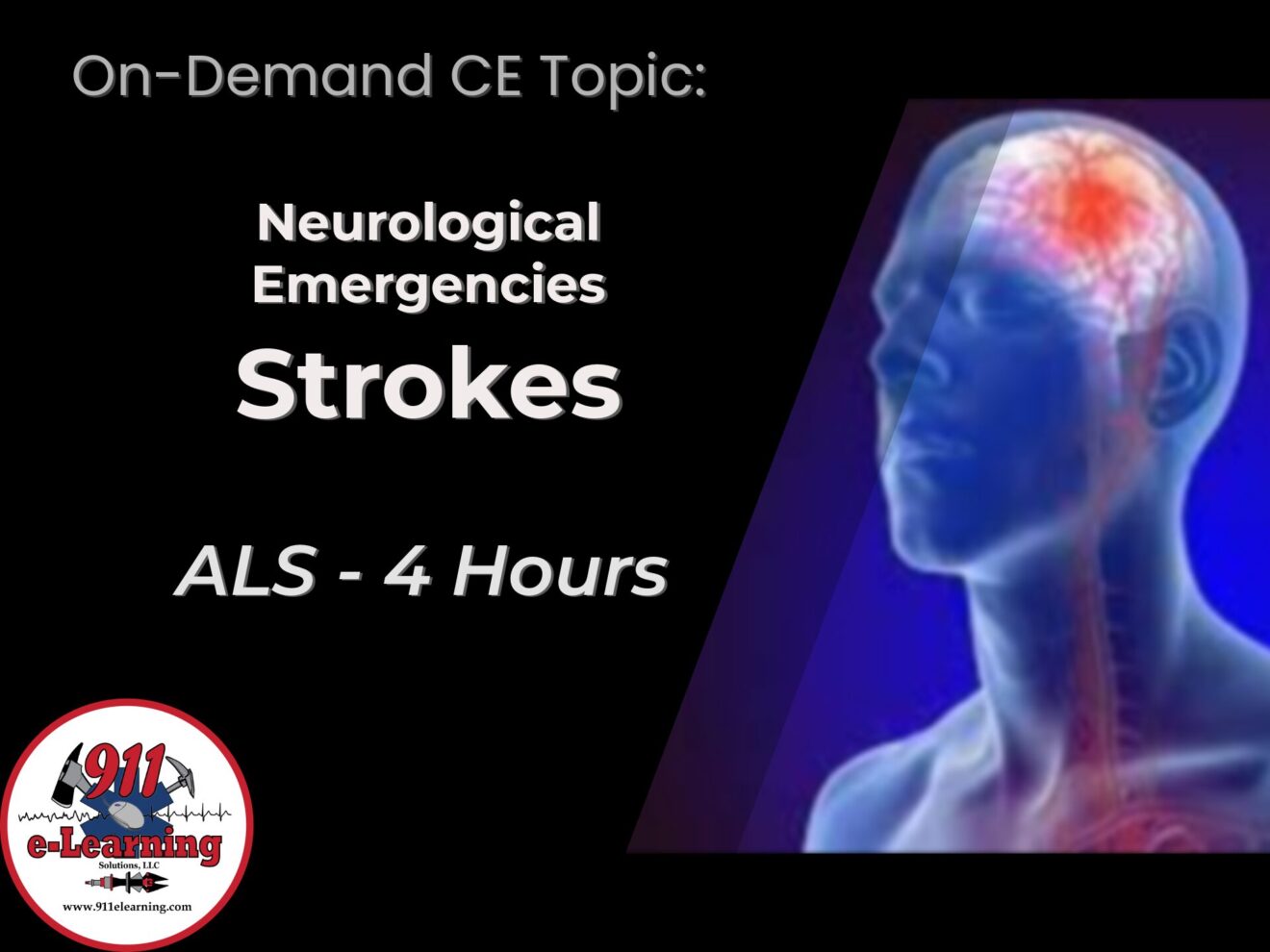 Neurological Emergencies for the ALS Provider: Strokes - 911 e-Learning ...